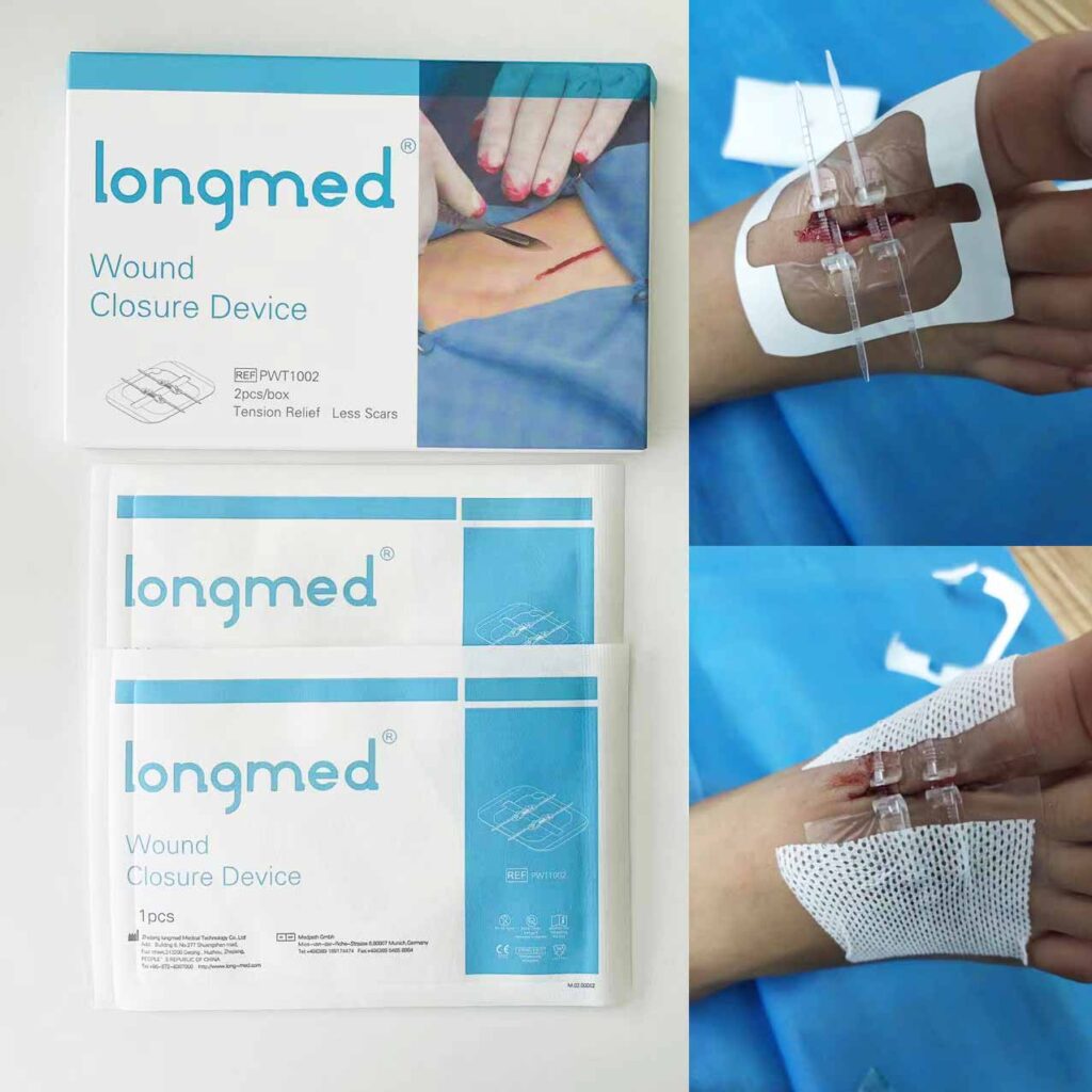 Zhejiang Longmed Medical Technology Co., Ltd