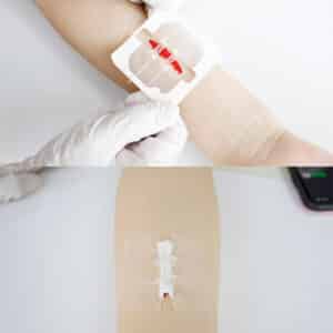 Band Aid Longmed Wound Closure Strips - Longmed Medical